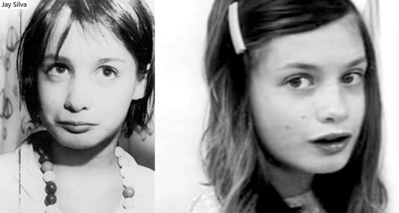 İstismar Edilen Genie Wiley Beyin Gelişimi Hakkında Ne Öğretti?