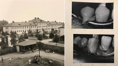 Vipeholm Deneyleri: Dişlerin Nasıl Çürüdüğünü Anlamamızı Sağlayan ...