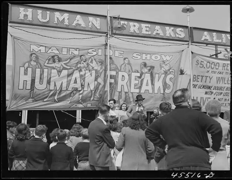 Güzel ve Çirkin Masalına İlham Veren Hipertrikoz (Kurt Adam Hastalığı ...