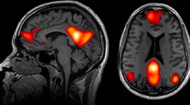 Sinirbilime Göre Yalnızlık Beynimizi Nasıl Etkiliyor?
